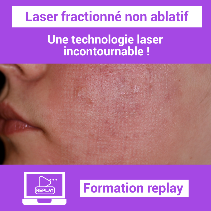 Laser Fractionné non ablatif : formation en replay